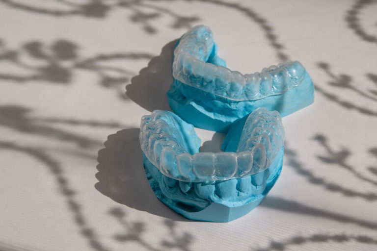 Tipos de Invisalign: quais são e as diferenças entre eles